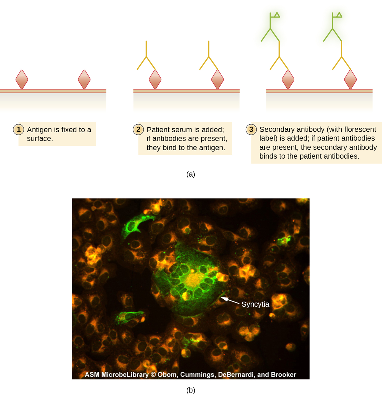 Fluorescent Antibody Techniques Tutorial | Sophia Learning