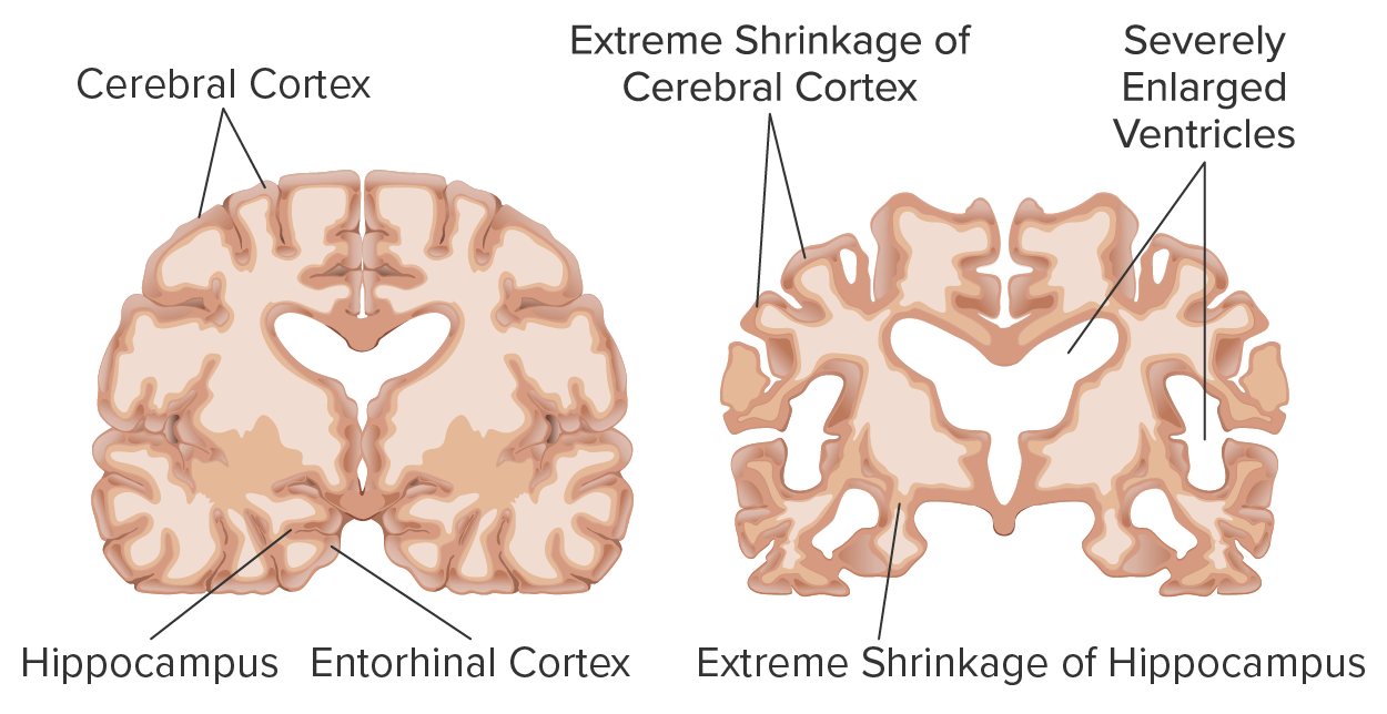 Cognitive Changes in Late Adulthood Tutorial | Sophia Learning