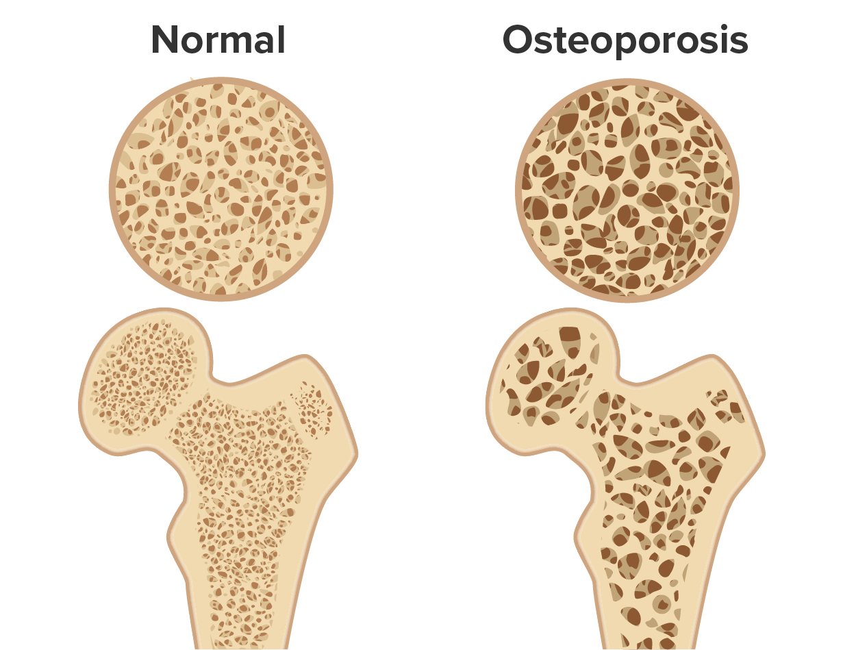 The Urinary System and Homeostasis Tutorial | Sophia Learning