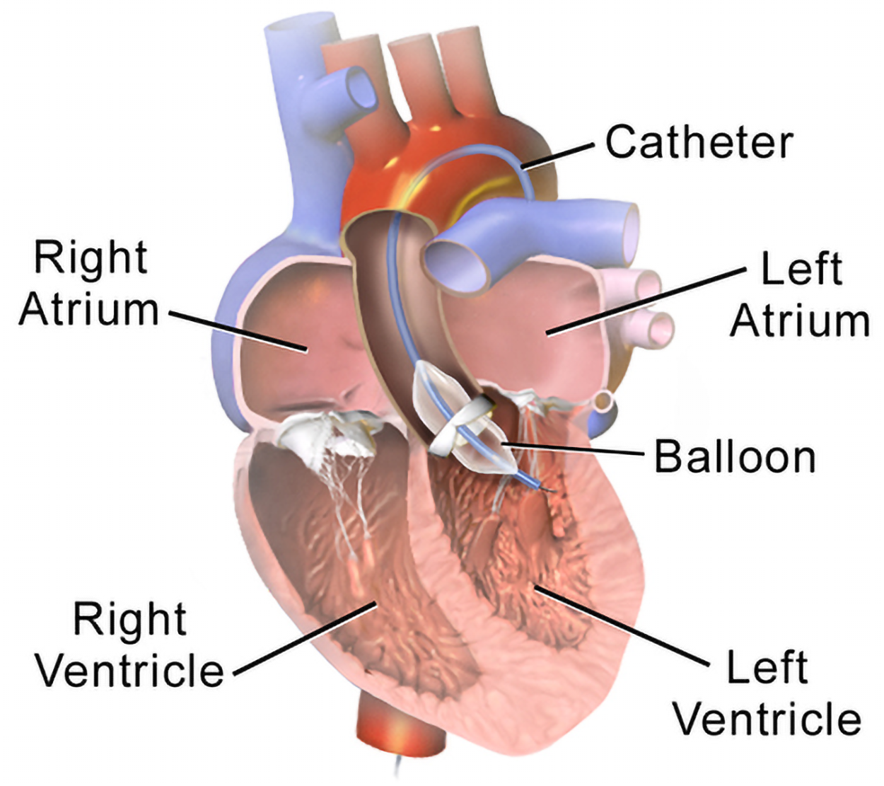 Cardiovascular System Diagnostic, Surgical, and Therapeutic Procedures ...