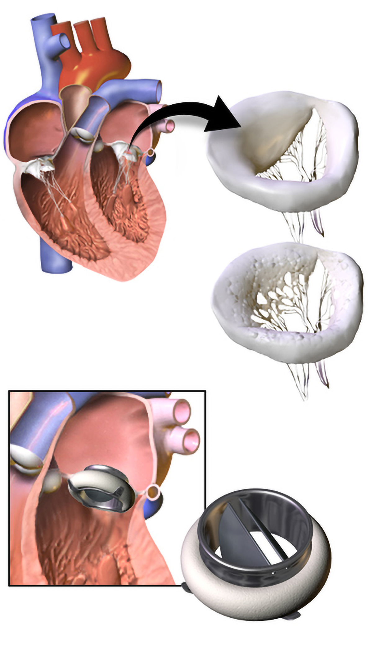 Cardiovascular System Diagnostic, Surgical, and Therapeutic Procedures ...