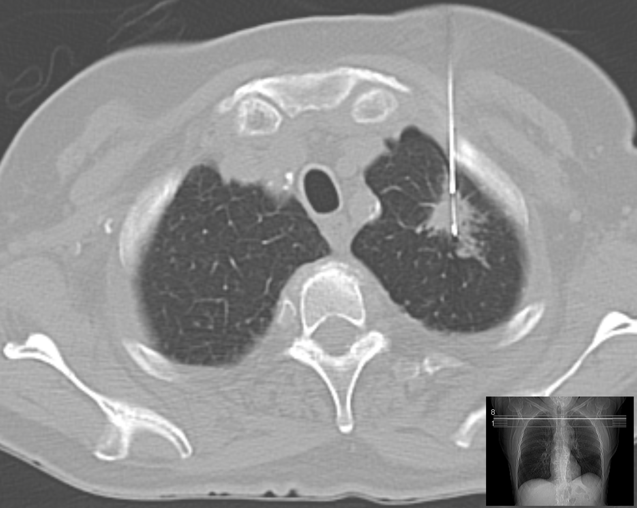Respiratory Diagnostic, Surgical, and Therapeutic Procedures Tutorial ...