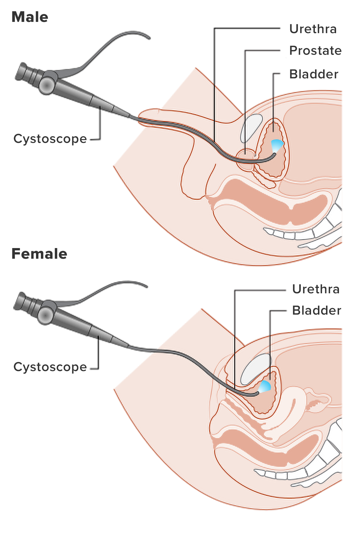 Urinary System Diagnostic, Surgical, and Therapeutic Procedures ...
